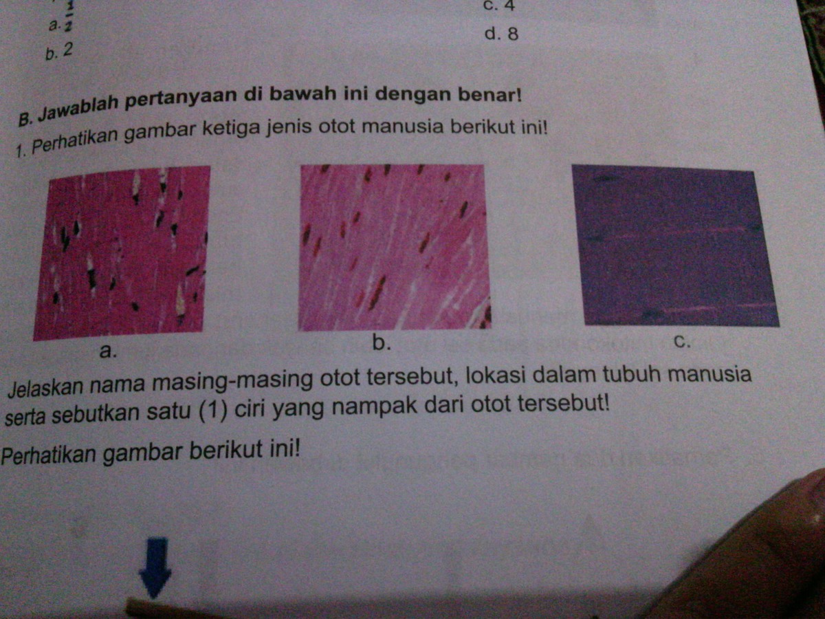 Detail Perhatikan Gambar Ketiga Jenis Otot Manusia Berikut Ini Koleksi ... Detail Perhatikan Gambar Ketiga Jenis Otot Manusia Berikut Ini Koleksi ...